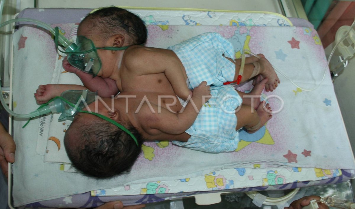 KEMBAR SIAM | ANTARA Foto