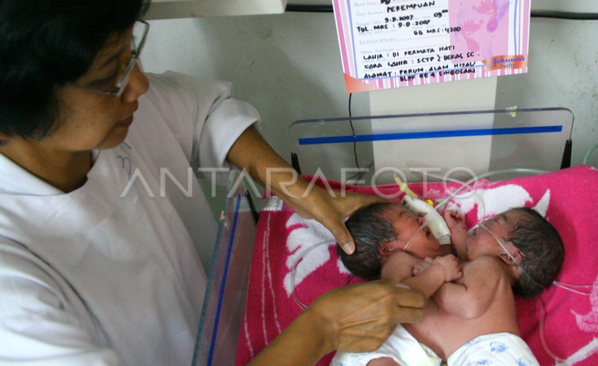 KEMBAR SIAM | ANTARA Foto