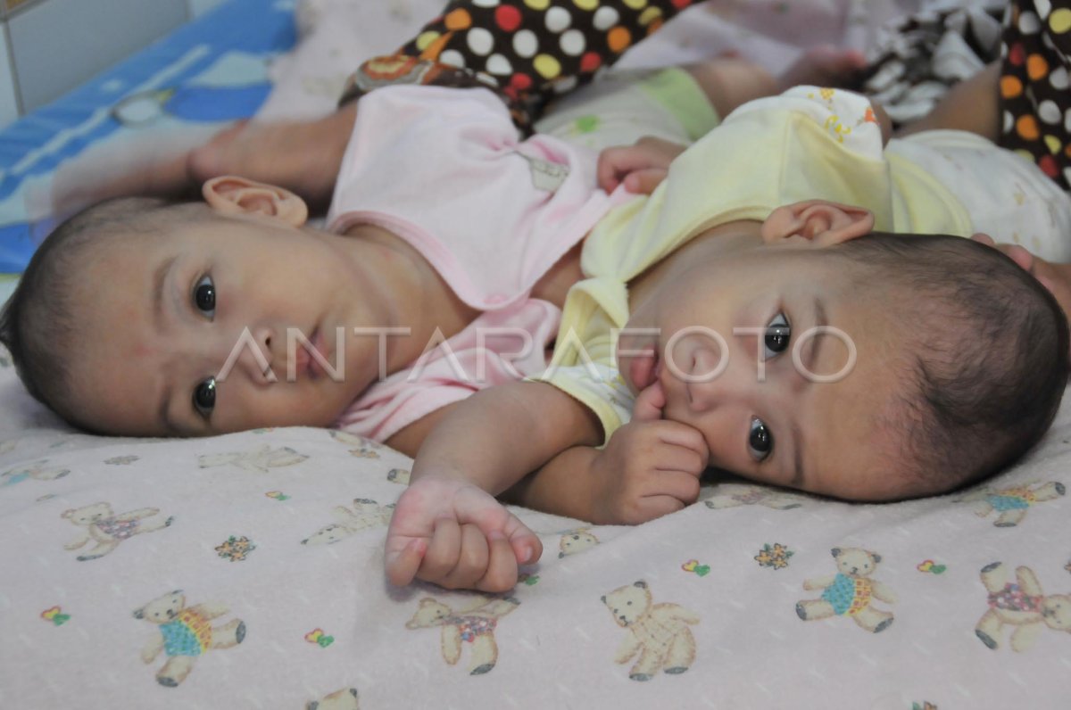 KEMBAR SIAM | ANTARA Foto