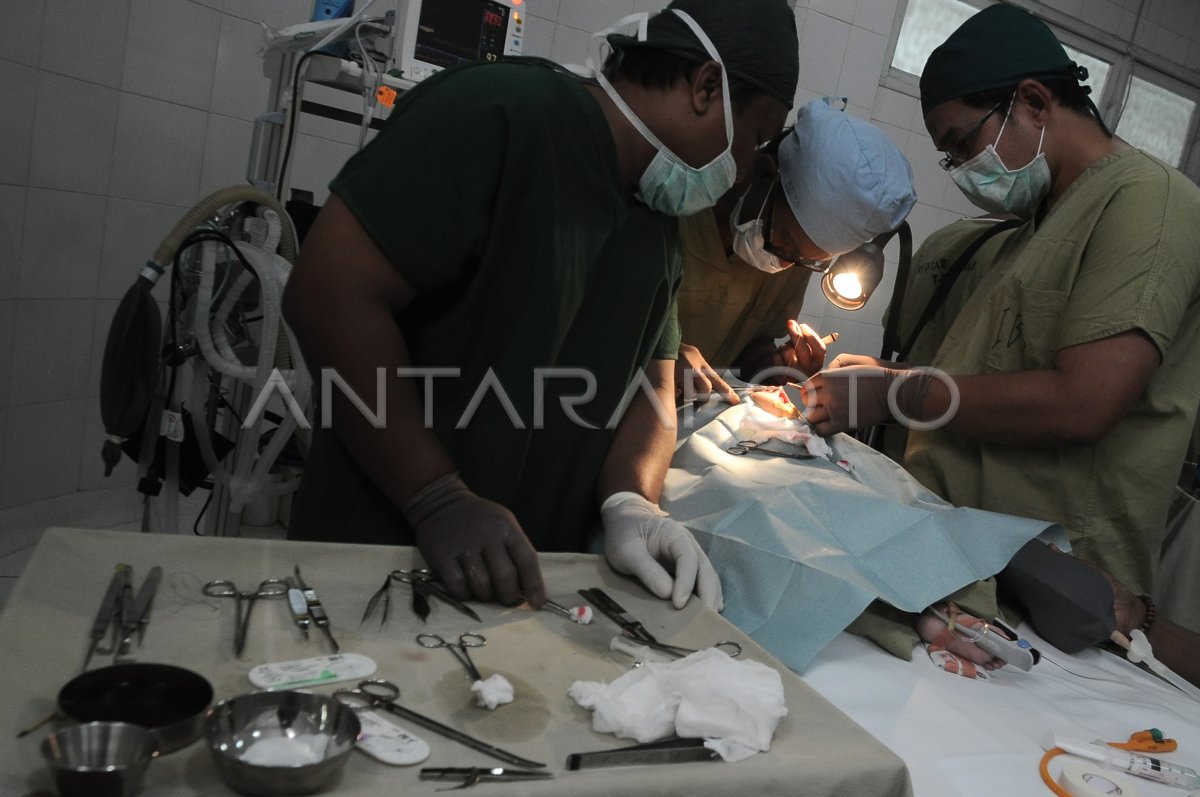 OPERASI BIBIR SUMBING | ANTARA Foto OPERASI BIBIR SUMBING | ANTARA Foto
