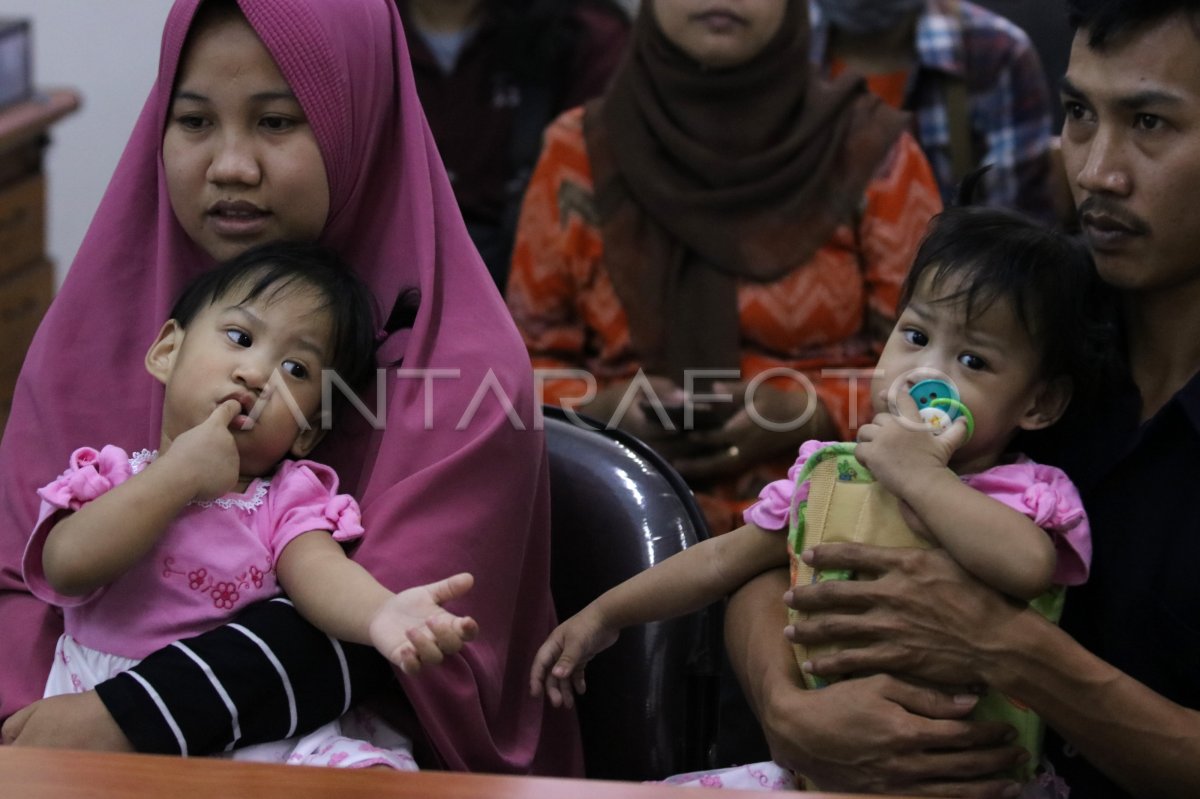 KEADAAN BAYI KEMBAR SIAM ASAL KENDARI | ANTARA Foto