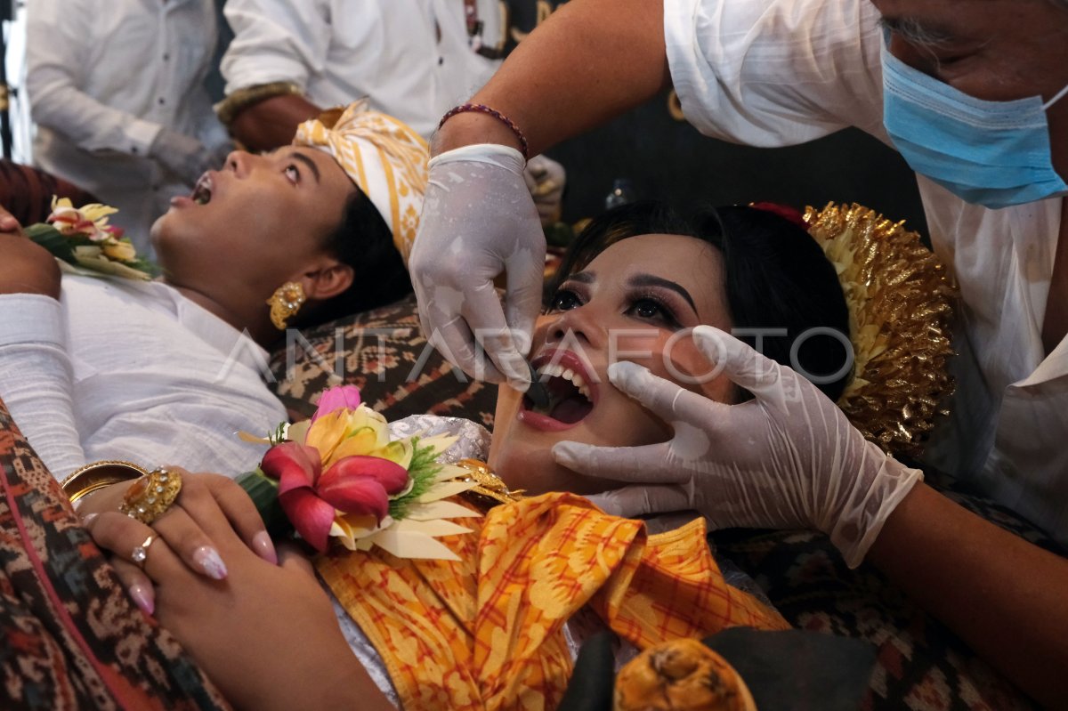 Upacara Potong Gigi Bagi Penyandang Disabilitas Antara Foto