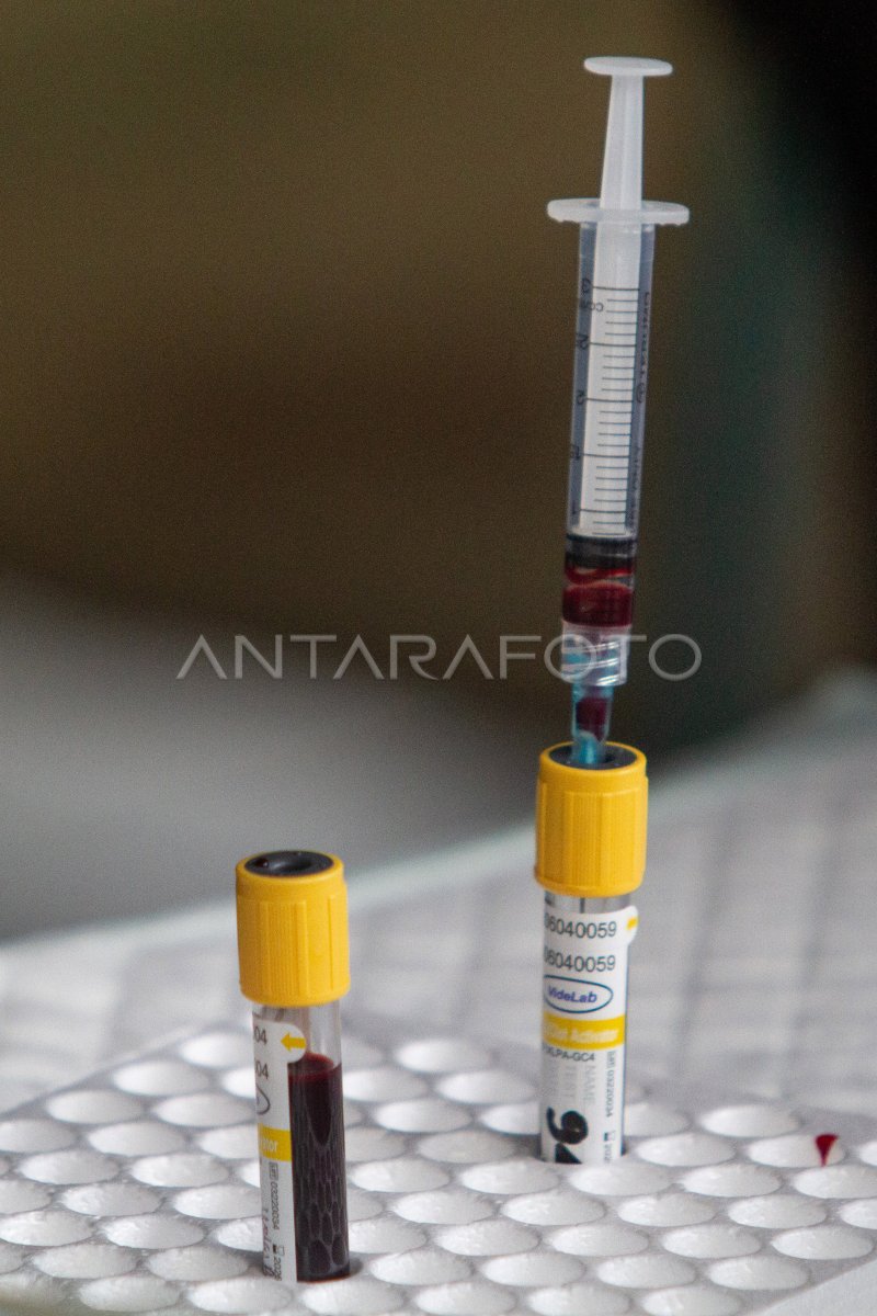 Pengambilan sampel darah kasus Antraks Gunungkidul | ANTARA Foto